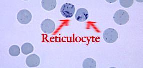 retikülosit - uludağ sözlük